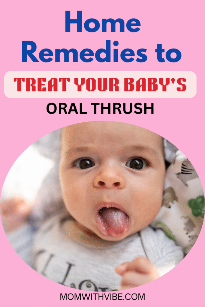 Home Remedies to Treat Your Baby's Oral Thrush - Mom With Vibe